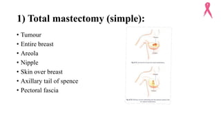 Breast carcinoma Management | PPTX