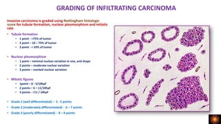 Morphology and prognosis of breast carcinoma - Dr.V.Shanthi | PPTX