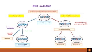Breast carcinoma etiopathogenesis - Dr.V.Shanthi | PPTX