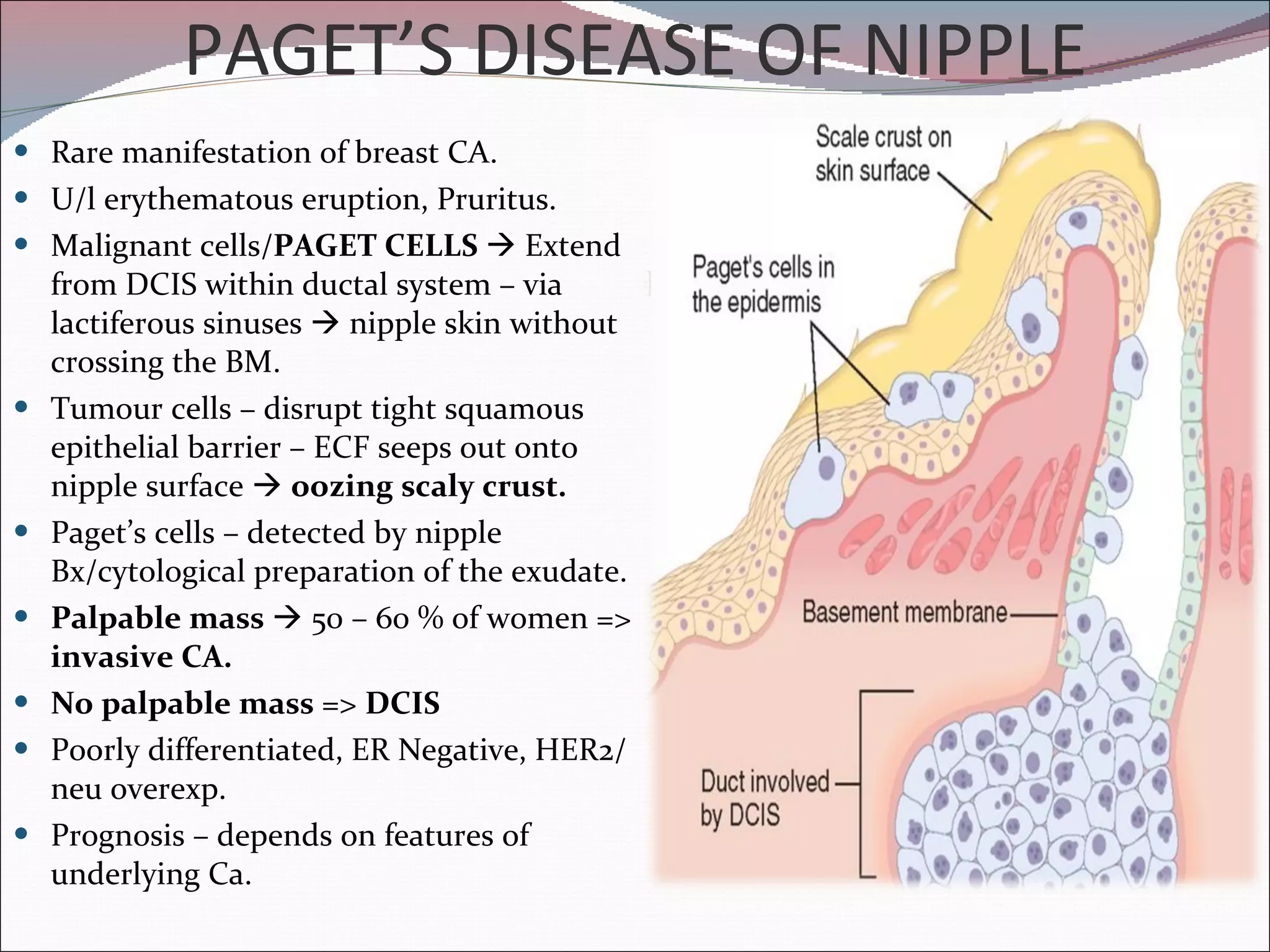 Breast carcinoma pathology | PPT