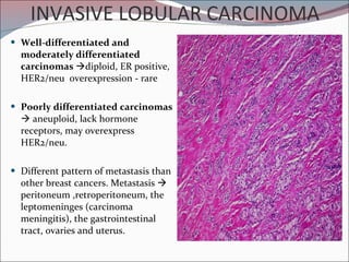 Pathology Slides Cancer
