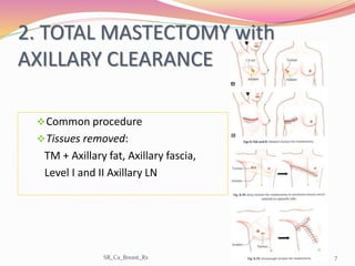MANAGEMENT OF BREAST CARCINOMA | PDF