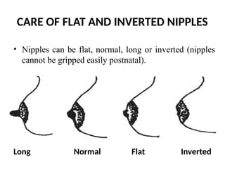 Early Pregnancy Areolas
