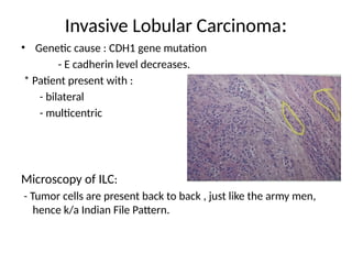 BREAST CLASSIFICATION and IHC 1 and 2.pptx