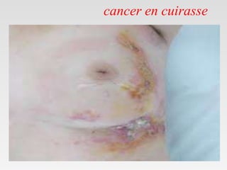 Breast Clinical Examination (unuploaded).pptx