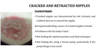 BREAST COMPLICATIONS.pptx