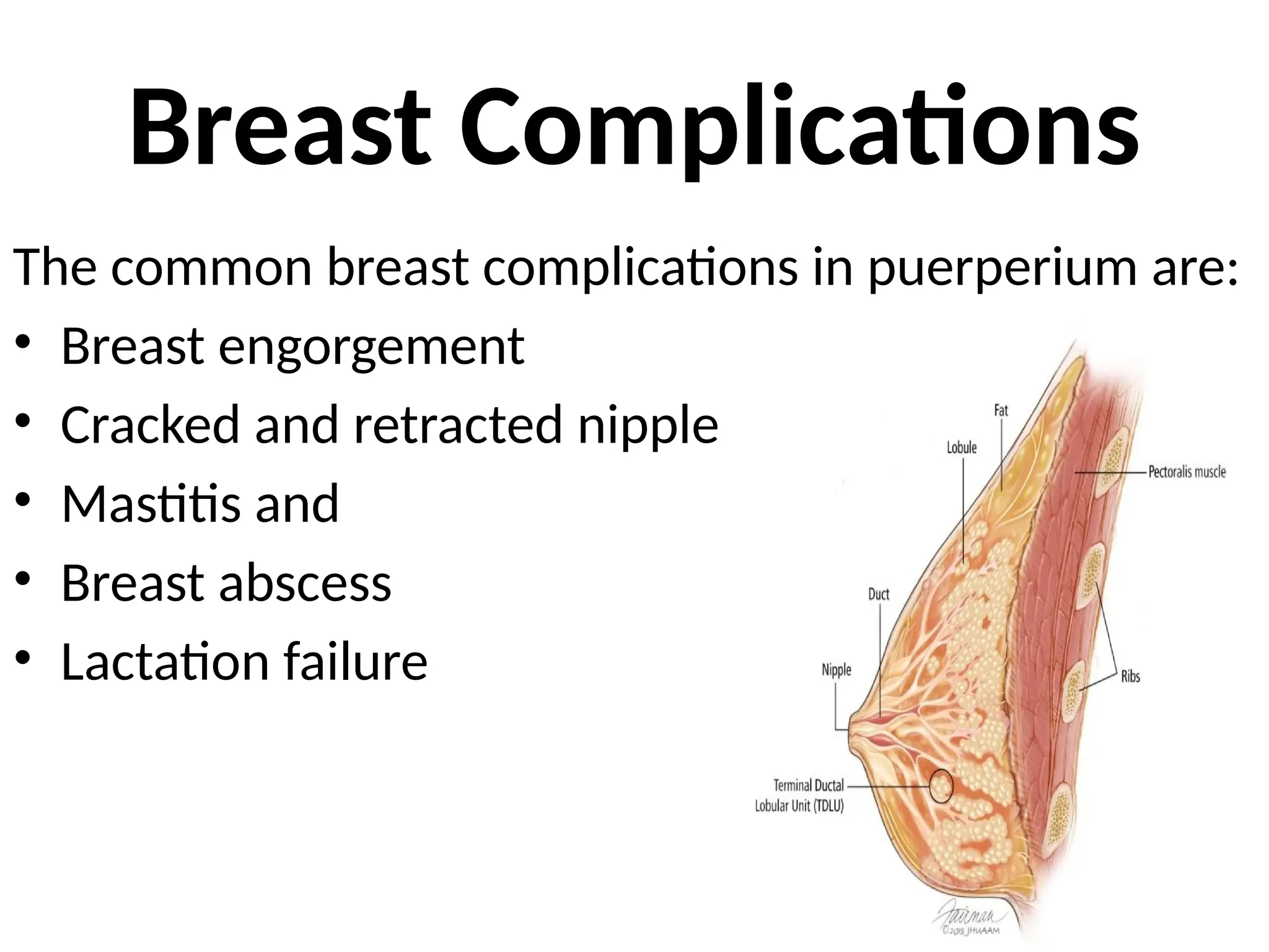 Breast Complications.pptx breast engorgement | PPTX