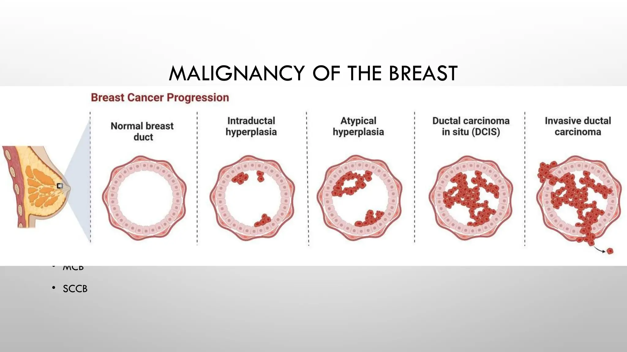 Breasts conditions seen our clinics.pptx
