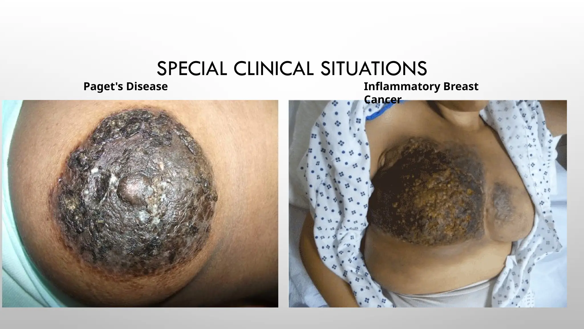 Breasts conditions seen our clinics.pptx
