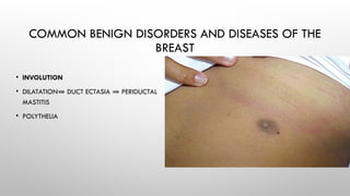 Breasts conditions seen our clinics.pptx