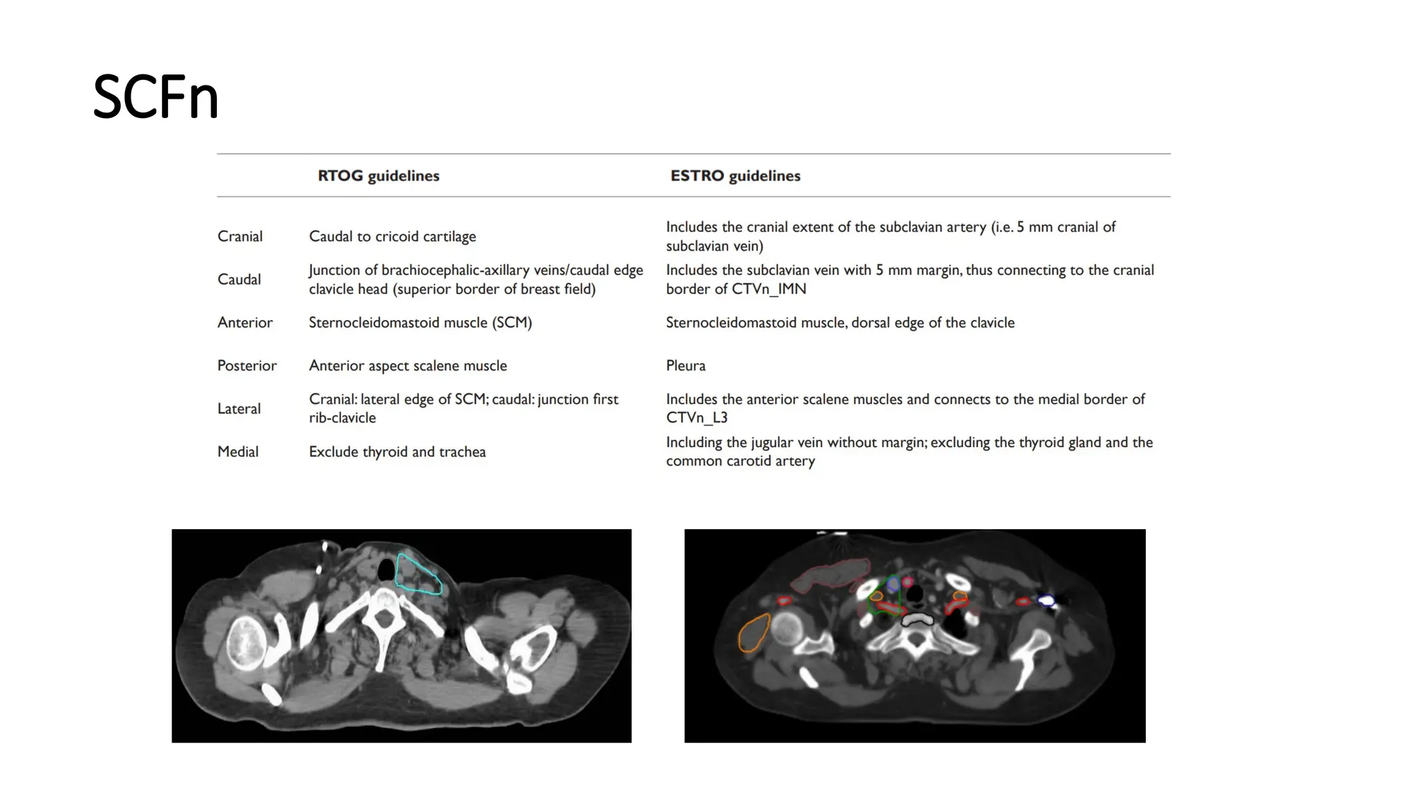 target delineation for breast and axillary nodes contouring.pptx