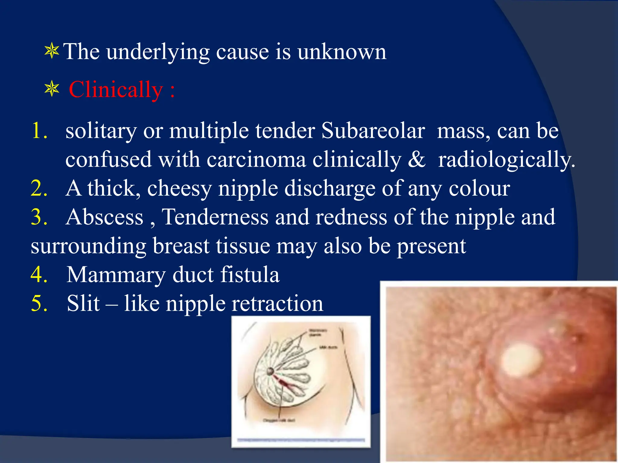 breast diseases. shaheed.pptx Benign Breast Diseases | PPT