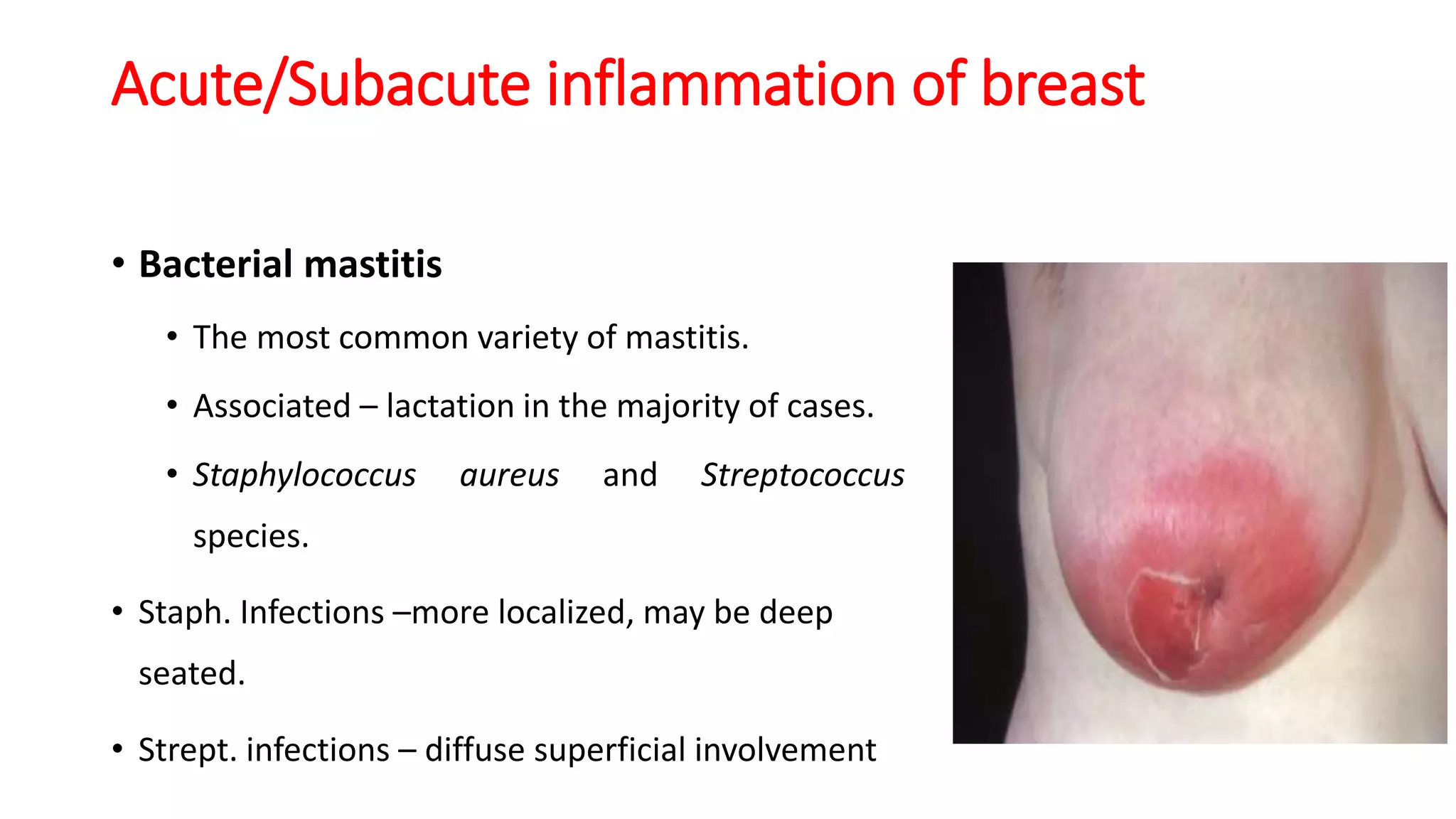 Breast disorders | PPTX