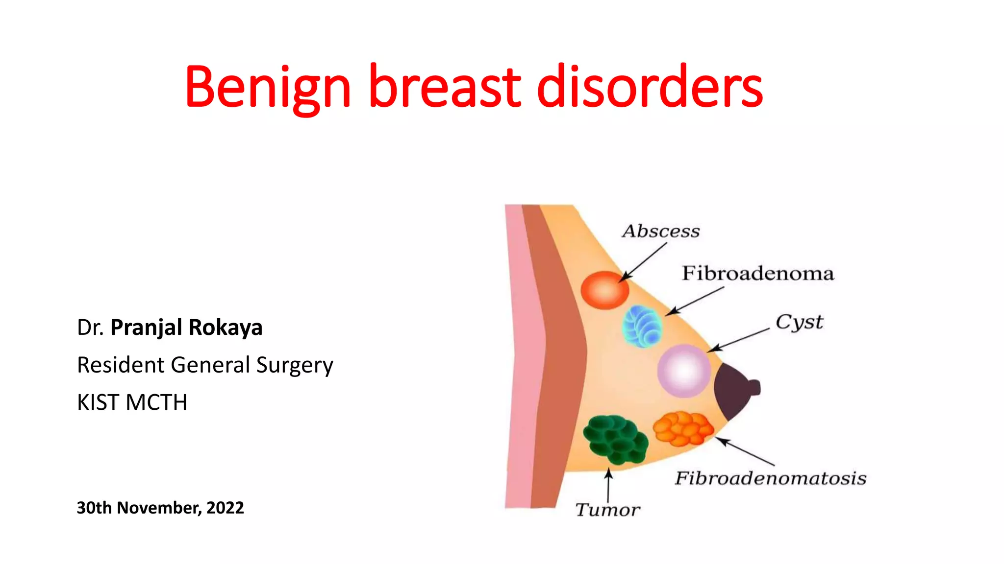 Breast disorders | PPT