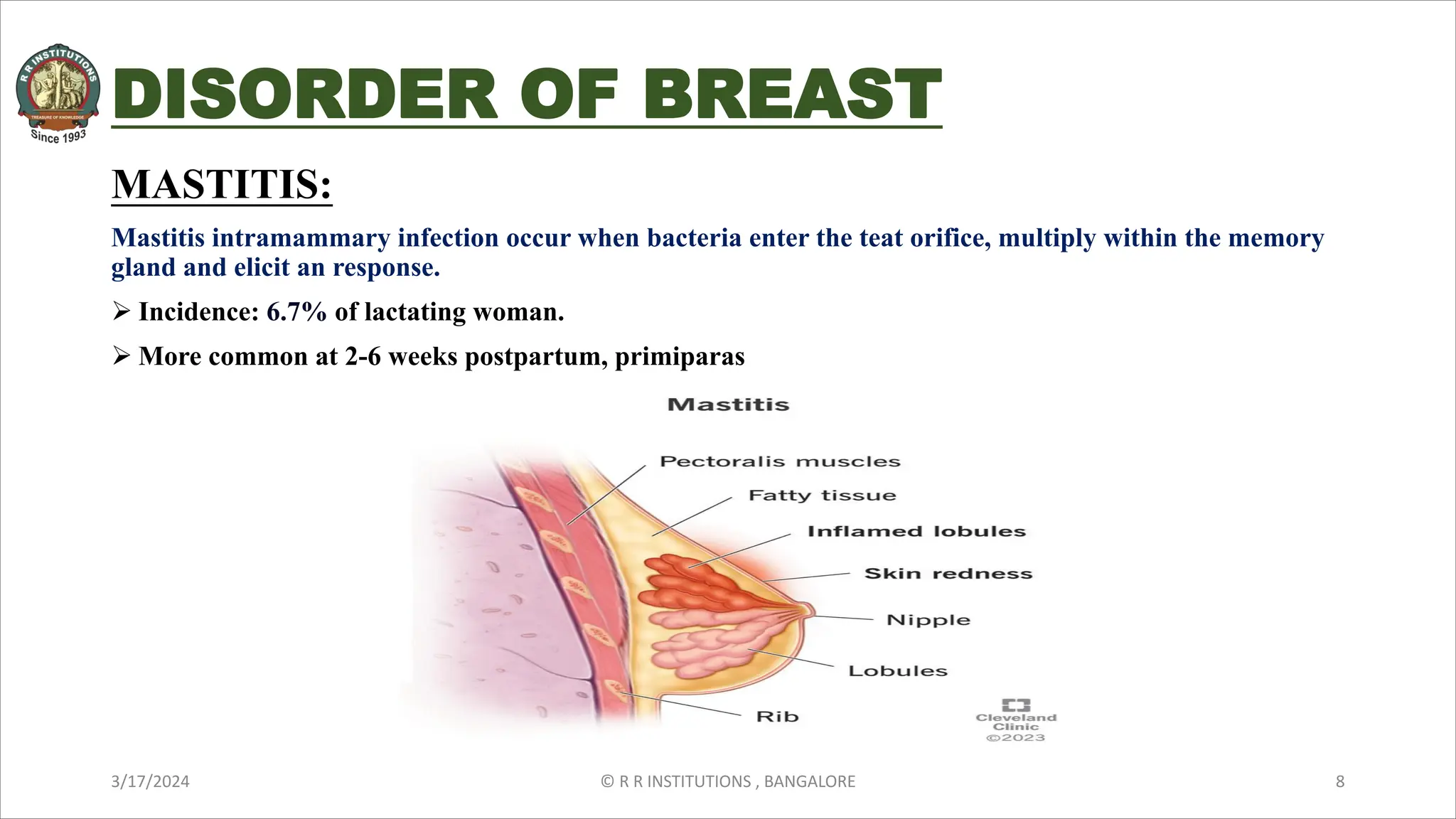 MASTITIS/BREAST ABSCESS/GYNECOMASTIA/BREAST TUMORS.pdf