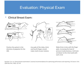 Clinical Breast Exam Diagram