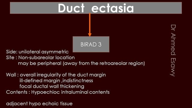 Breast duct ectasia us mammogram mri | PPTX