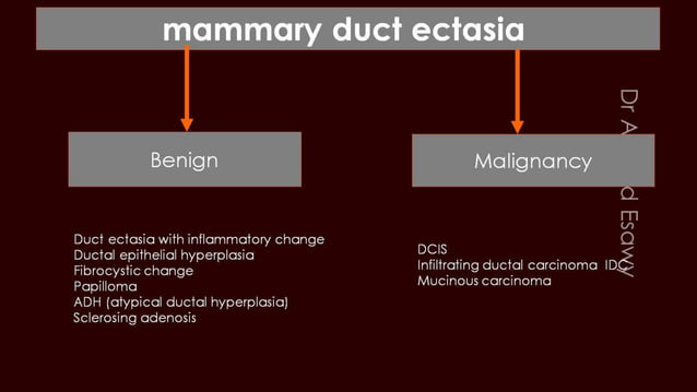 Breast duct ectasia us mammogram mri | PPTX