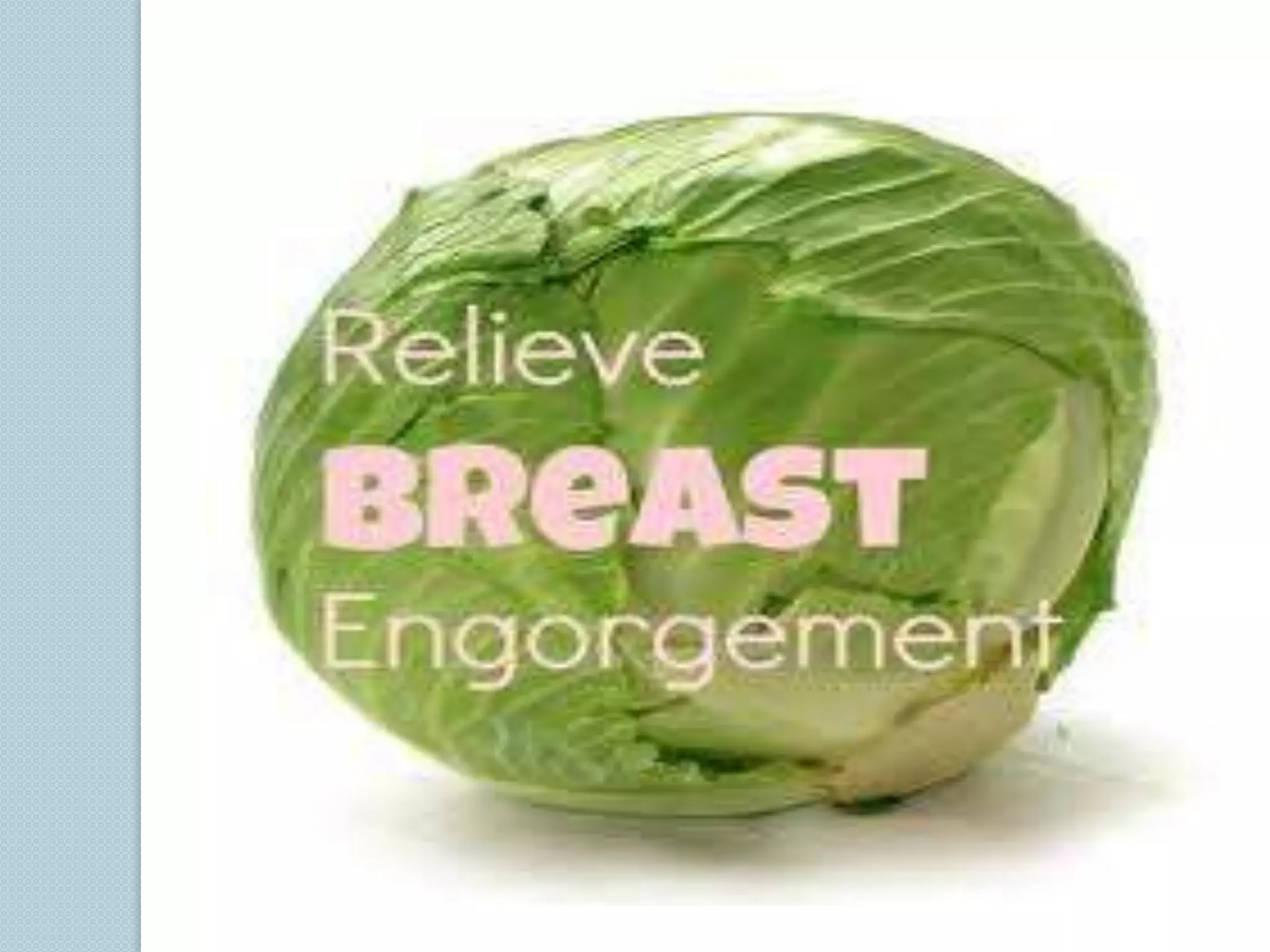 Breast engorgement | PPTX