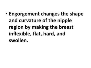 BREAST ENGORGEMENT | PPTX
