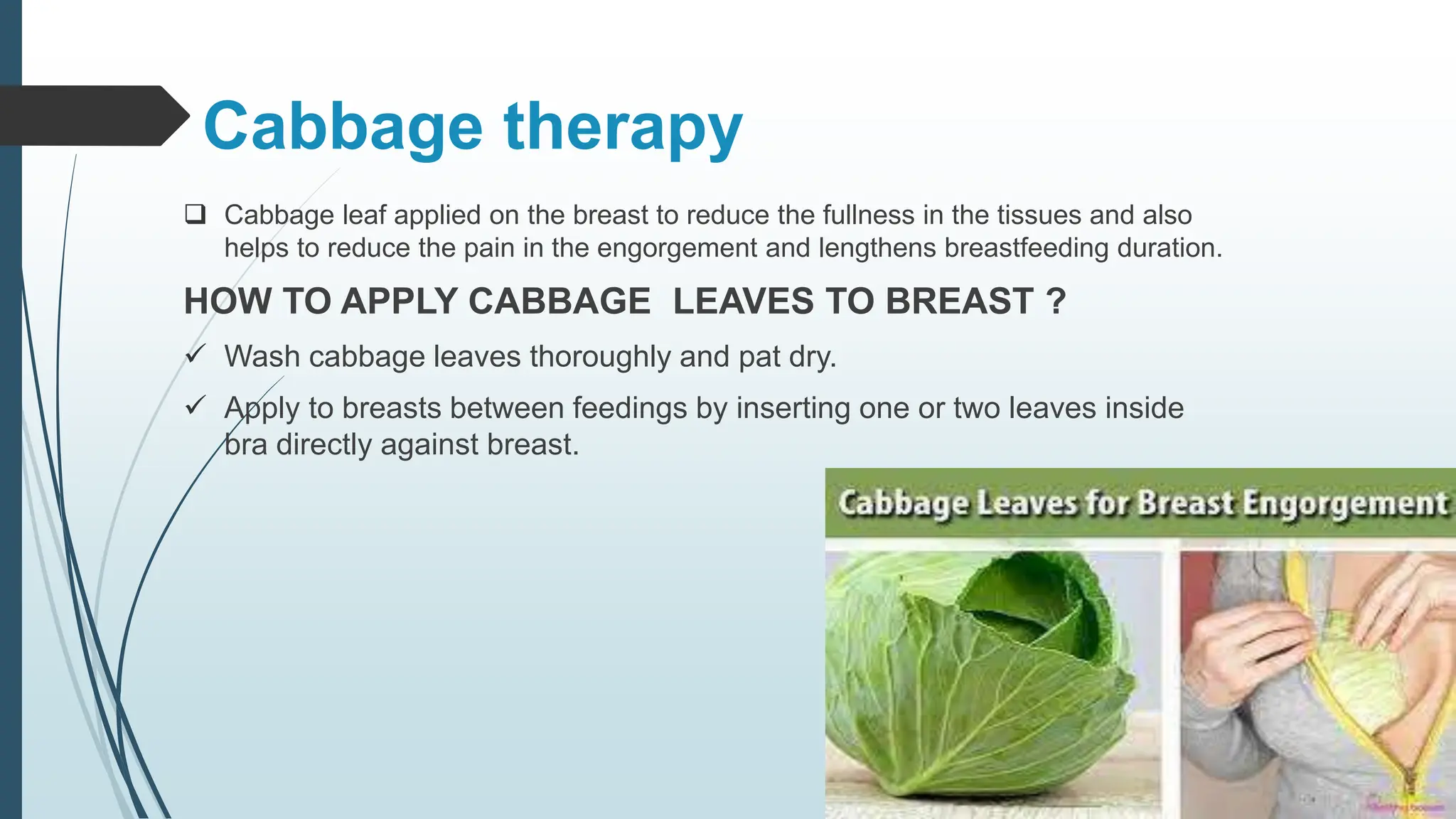 BREAST ENGORGEMENT and Its causes in female | PPTX