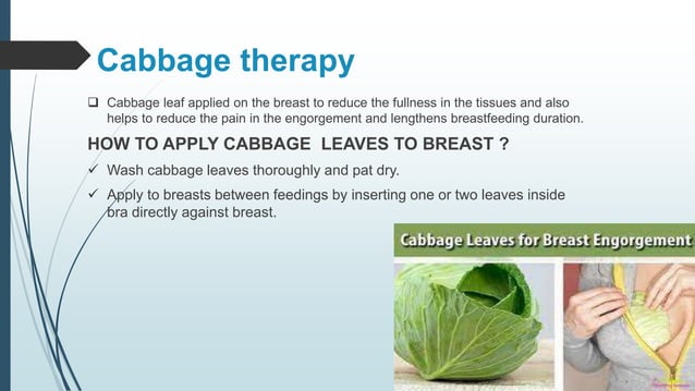 BREAST ENGORGEMENT and Its causes in female | PPTX | Pregnancy ...