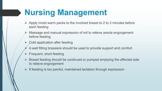 BREAST ENGORGEMENT and Its causes in female | PPTX