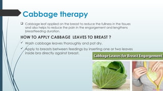 BREAST ENGORGEMENT.pptx definition types treatment prevention | PPTX