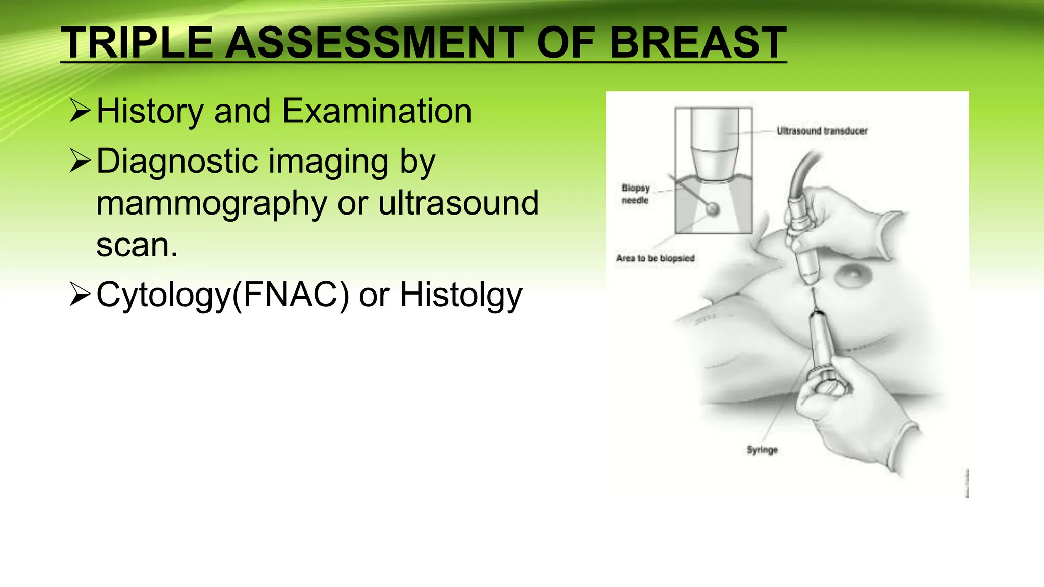 Breast Examination.pptx examination of axillary lymph node | PPTX