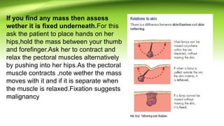 Breast Examination.pptx examination of axillary lymph node | PPTX