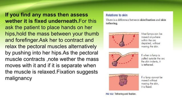 Breast Examination.pptx examination of axillary lymph node | PPTX ...