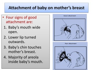 Breast feeding | PPT