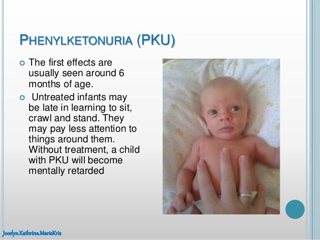Breastfeeding & Newborn Screening