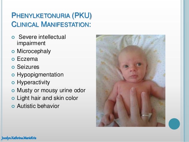 Phenylketonuria Symptoms