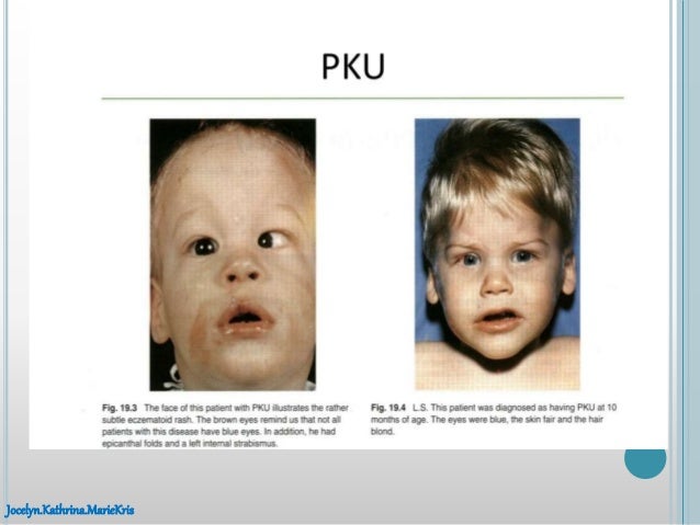 Breastfeeding & Newborn Screening