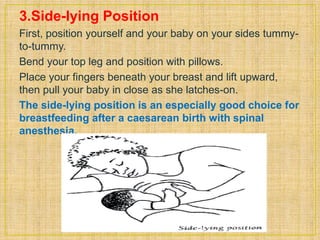 Breastfeeding | PPTX