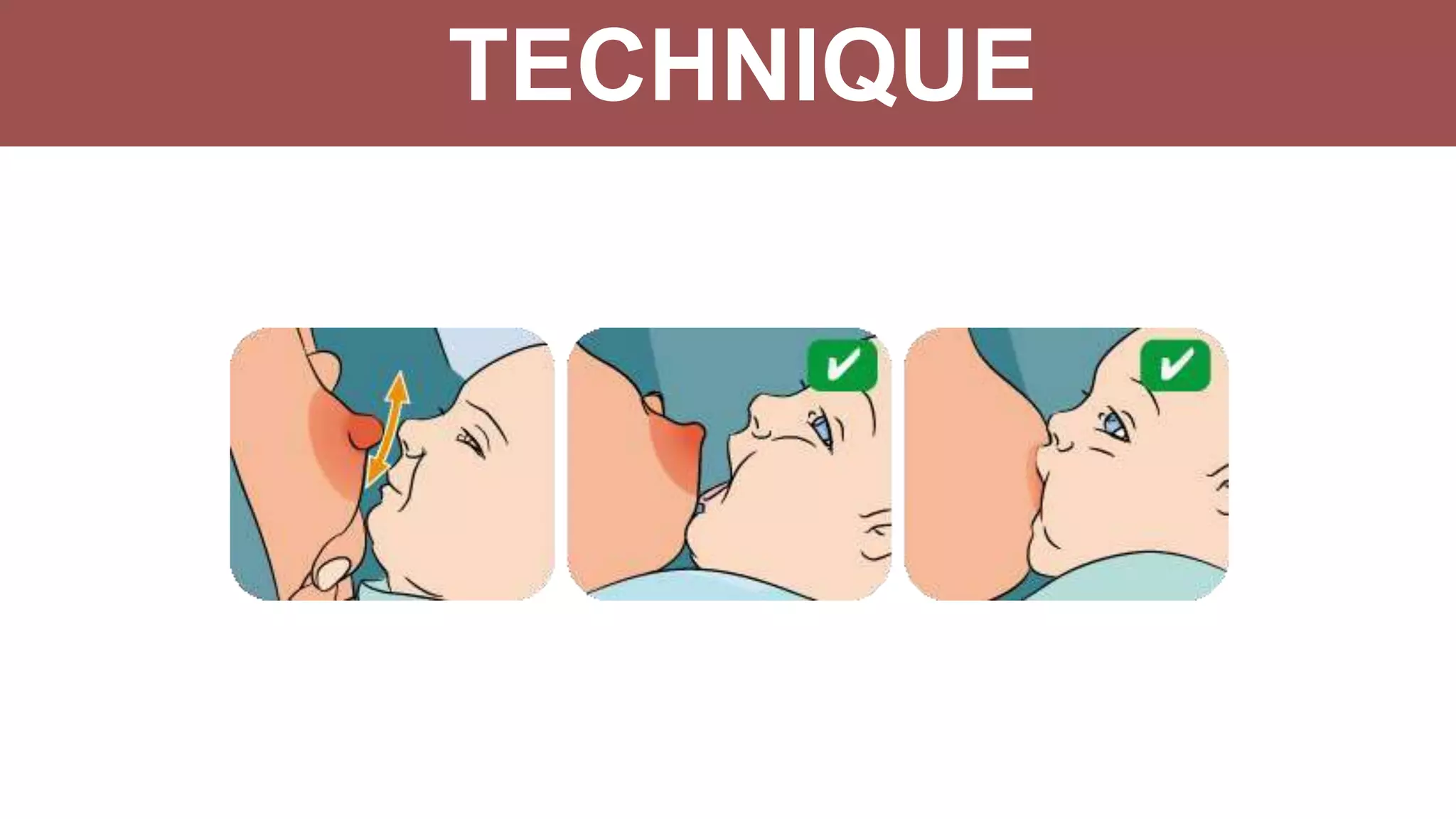 Breastfeeding (CHILD HEALTH NURSING) | PPTX