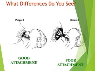 breastfeeding.pdf