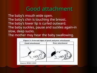 Breast feeding(Infant& Young child feeding) 2.ppt