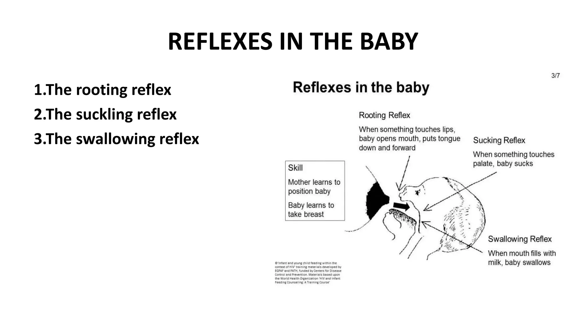 Breastfeeding seminar pediatrics | PPTX