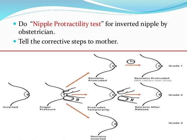 Breastfeeding week nyle