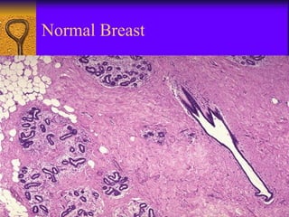 Breast_Histology presentation lecture.ppt