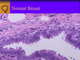 Breast_Histology presentation lecture.ppt