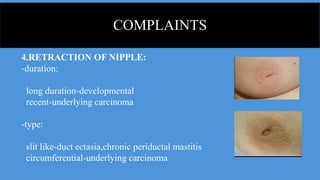 breast history and examination.final.pptx | Cancer | Diseases and ...