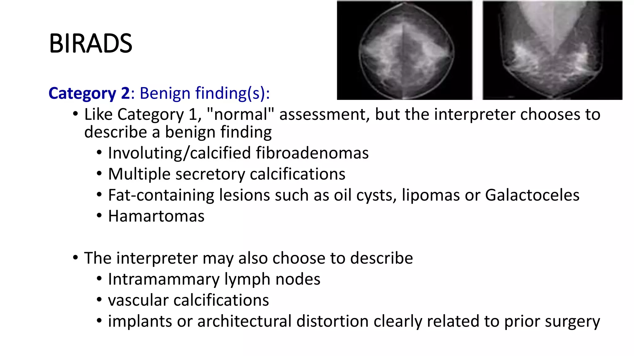 Breast imaging | PPTX