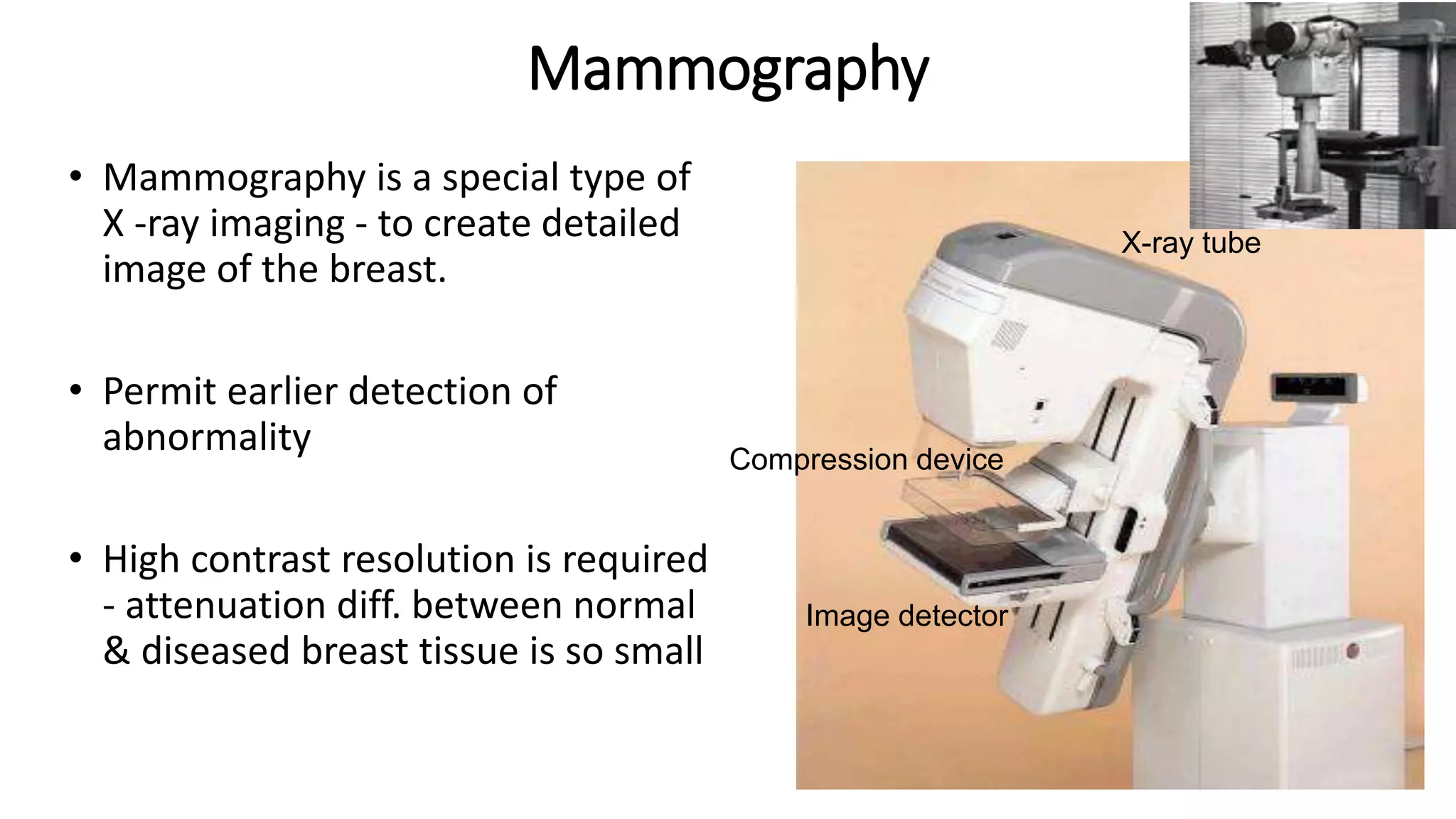 Breast imaging | PPTX