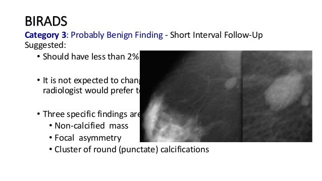 Breast imaging