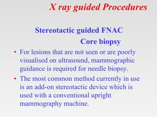 Breast imaging.pptx