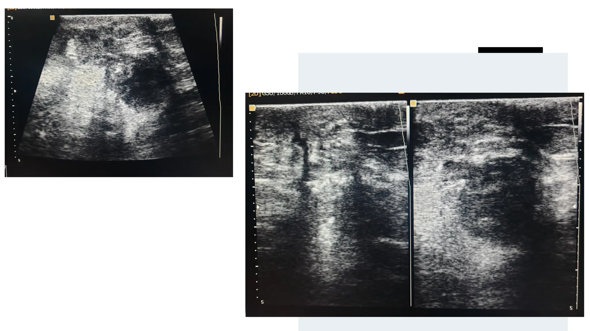 Multimodality imaging of the breast- BI-RADS | PPTX