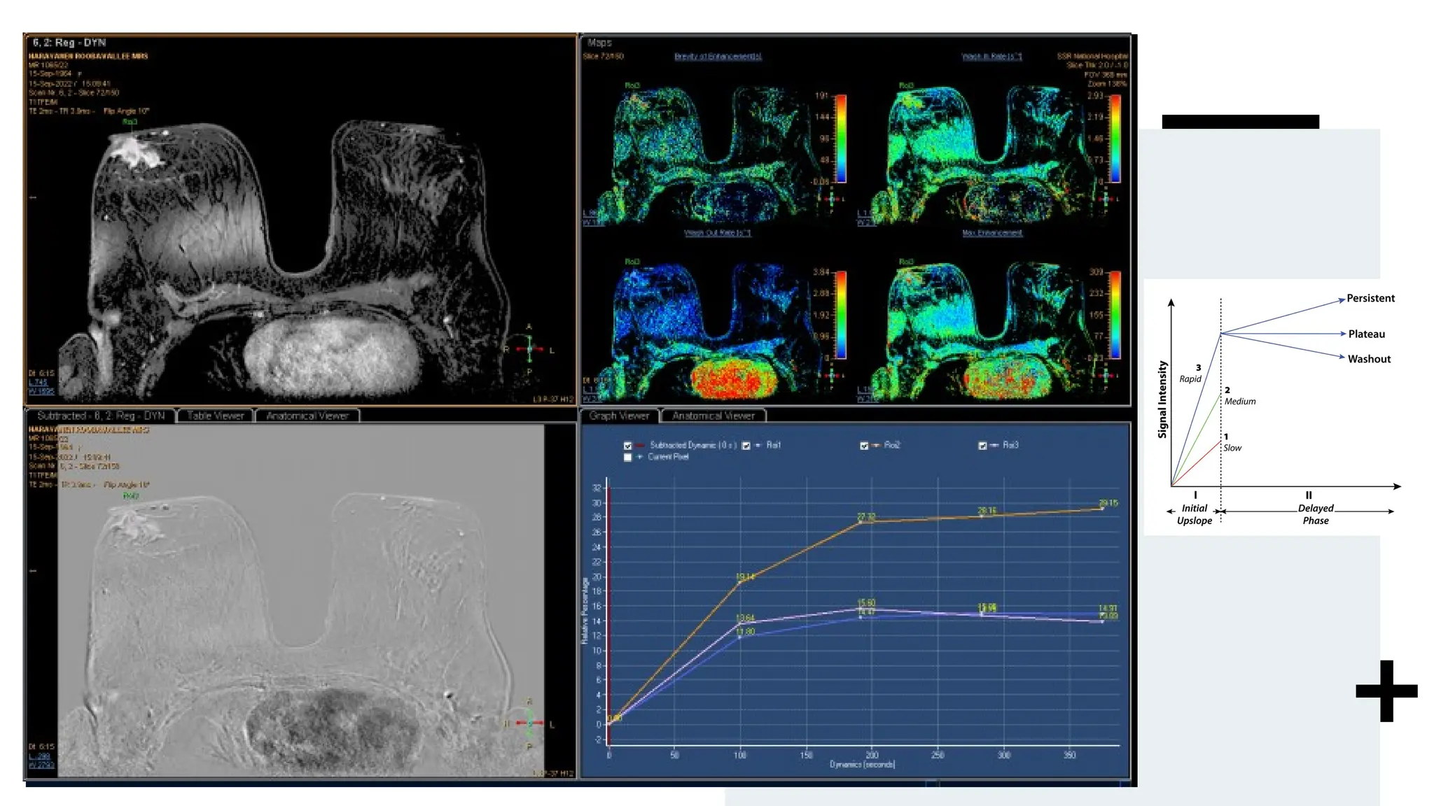 Multimodality imaging of the breast- BI-RADS | PPTX